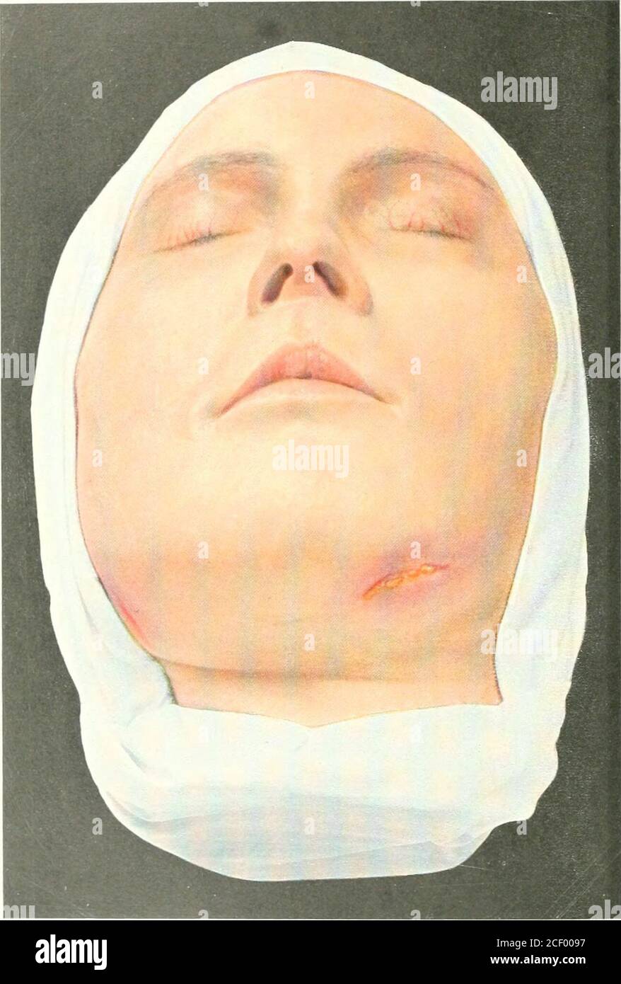 . Atlas of clinical surgery; with special reference to diagnosis and ...