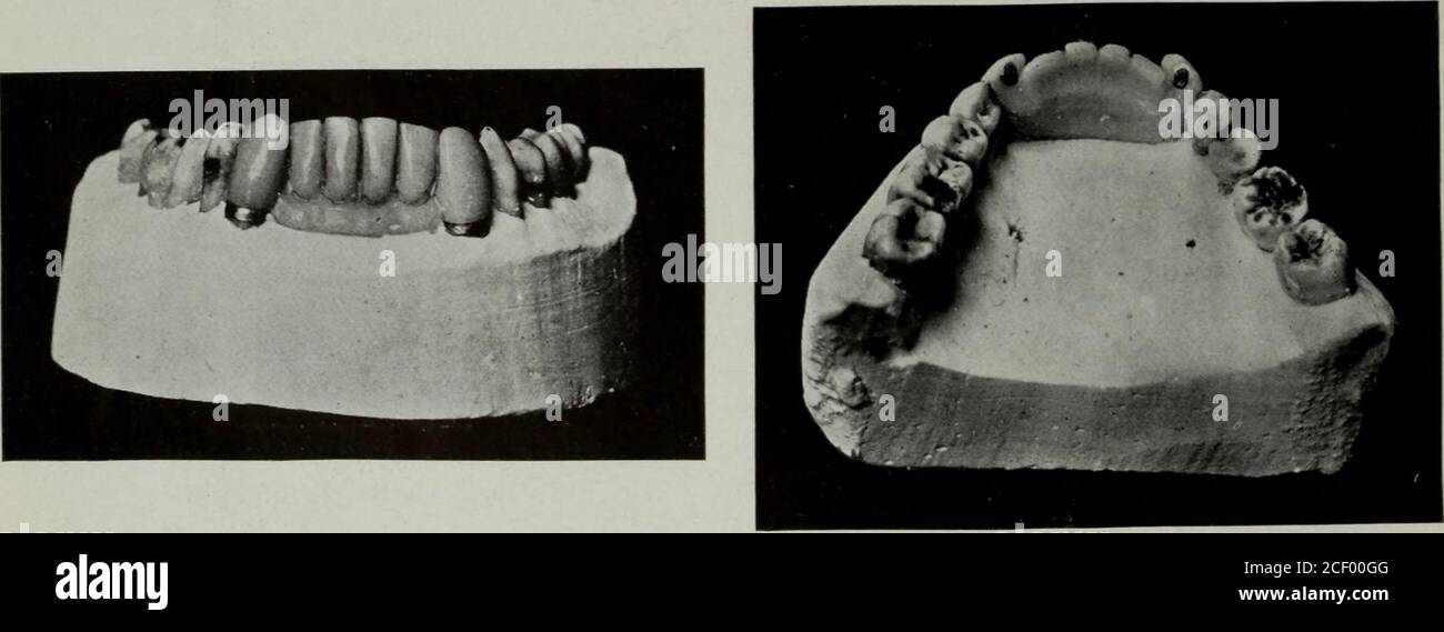 Broken bridge incident hi-res stock photography and images - Alamy