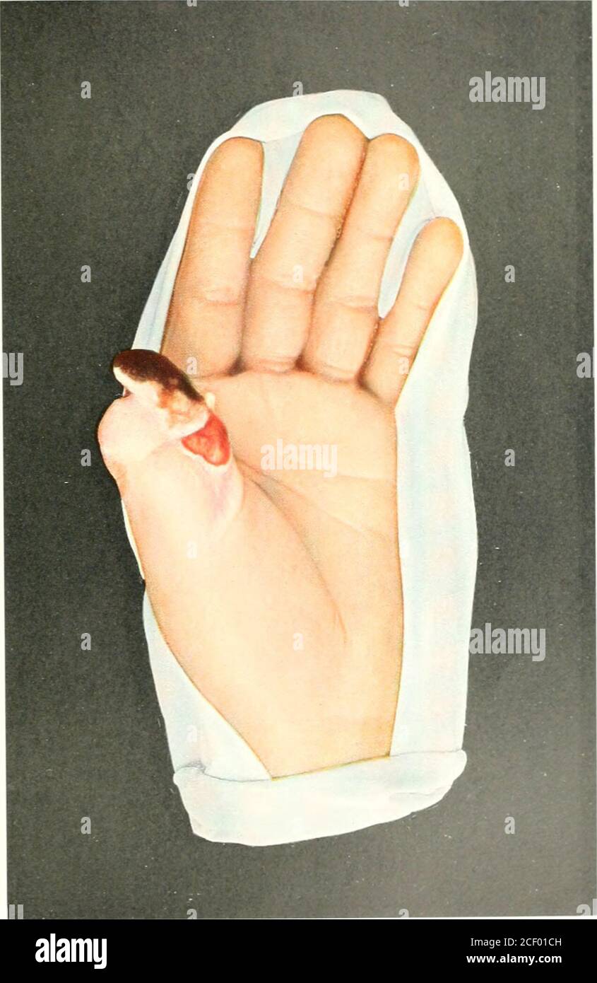 . Atlas of clinical surgery; with special reference to diagnosis and ...