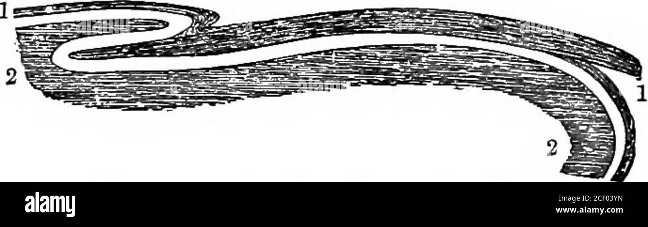 Skin grows back Black and White Stock Photos & Images - Alamy