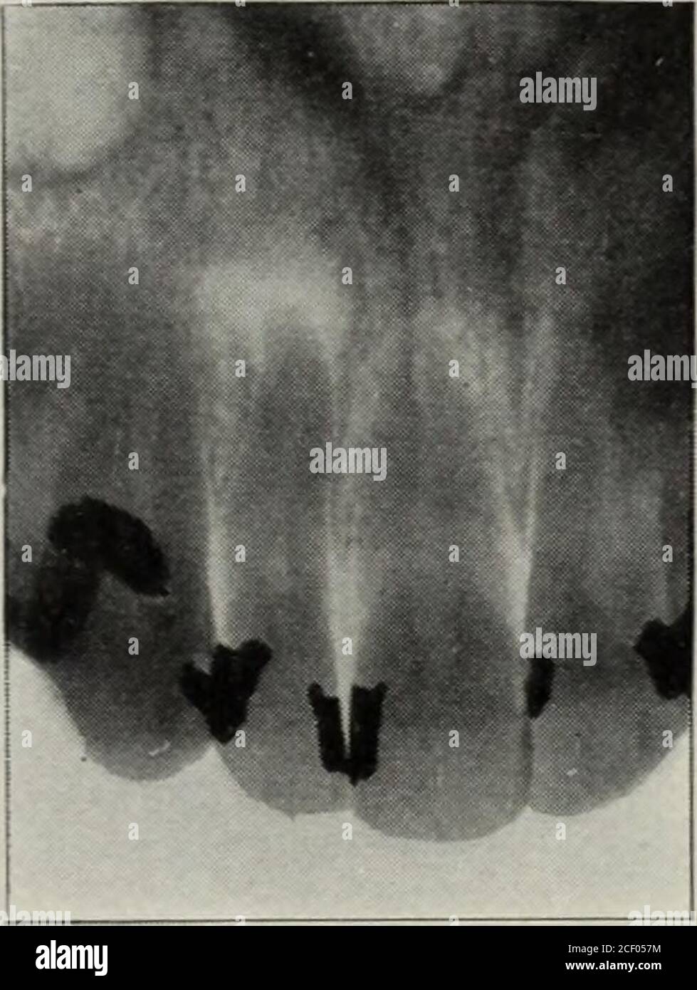 Septic mouth hi-res stock photography and images - Alamy