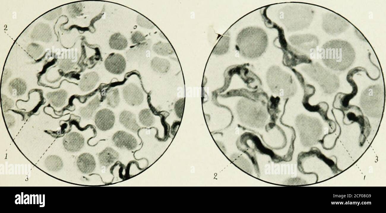 Maladie du sommeil hi-res stock photography and images - Alamy