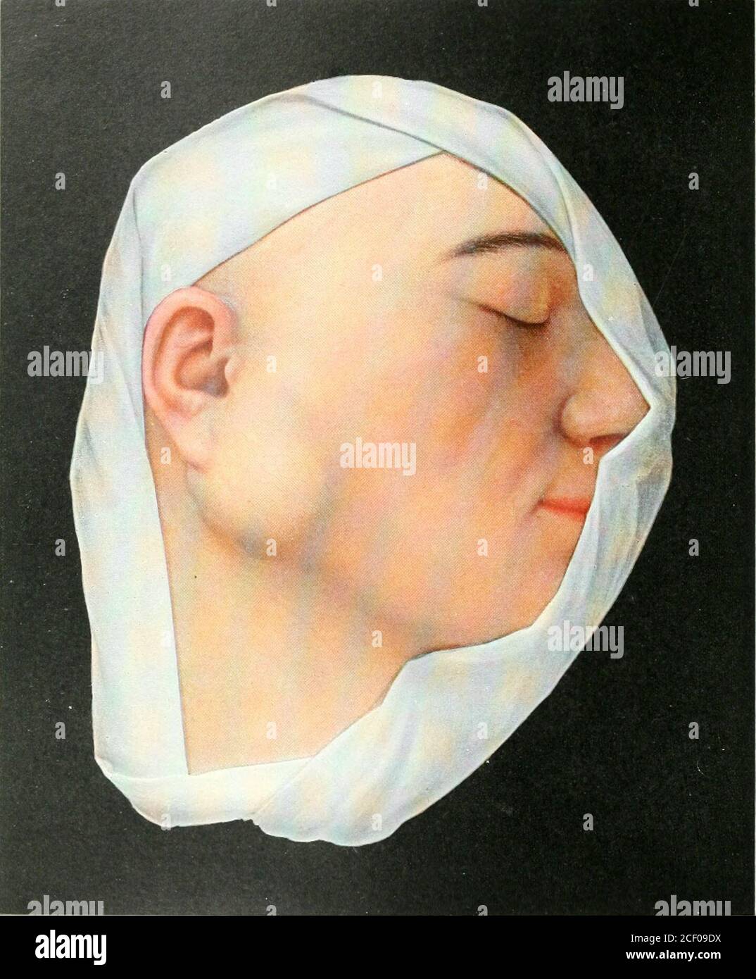 . Atlas of clinical surgery; with special reference to diagnosis and ...