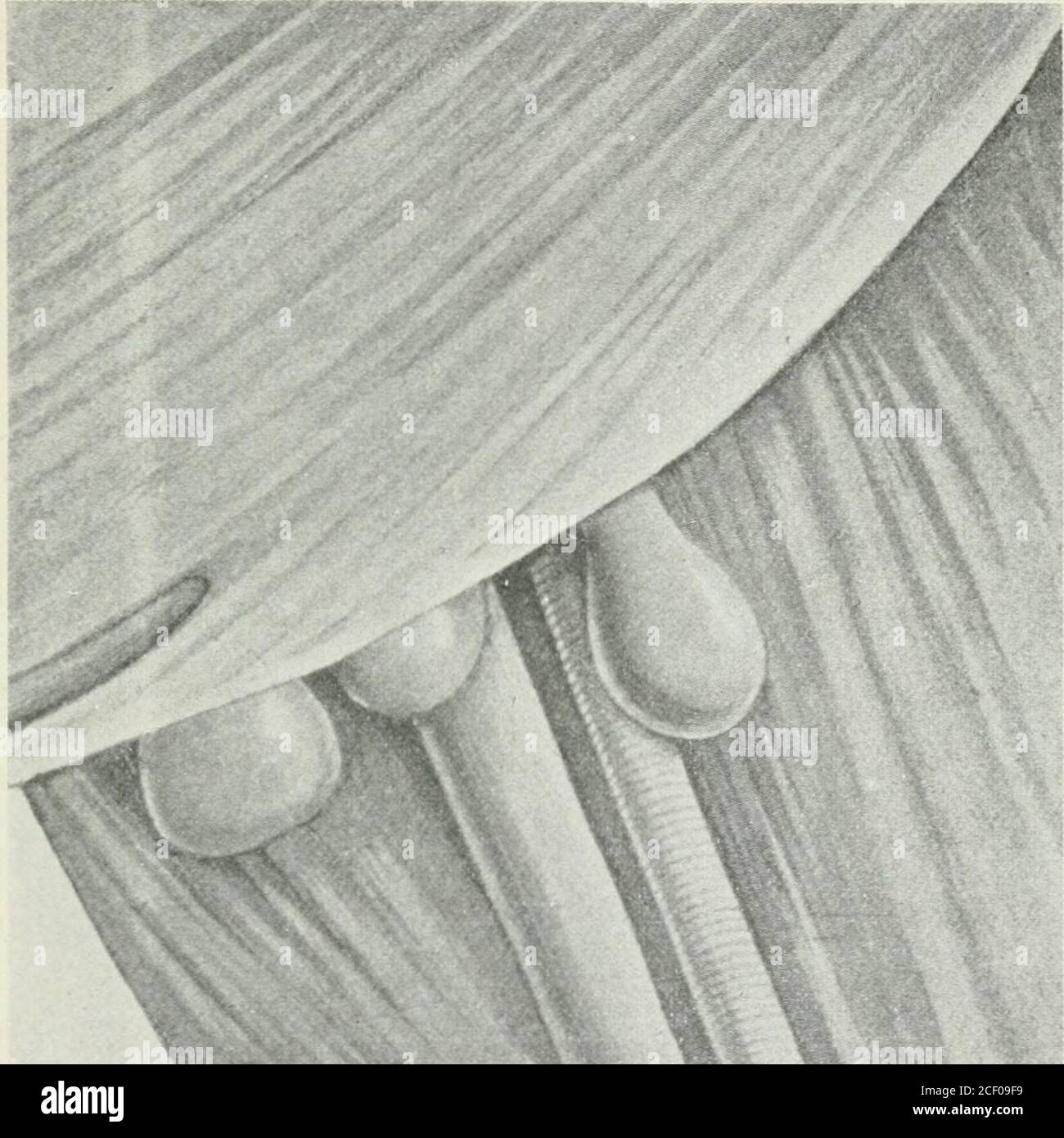 Congenital hydrocele hi-res stock photography and images - Alamy
