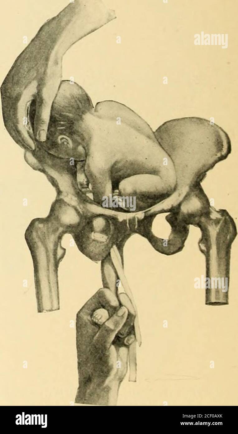 Axis engages hi-res stock photography and images - Alamy
