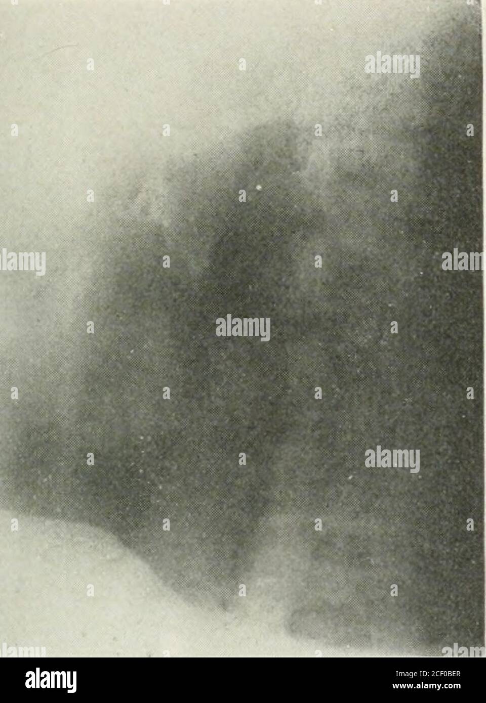 Hypochondrium hi-res stock photography and images - Alamy