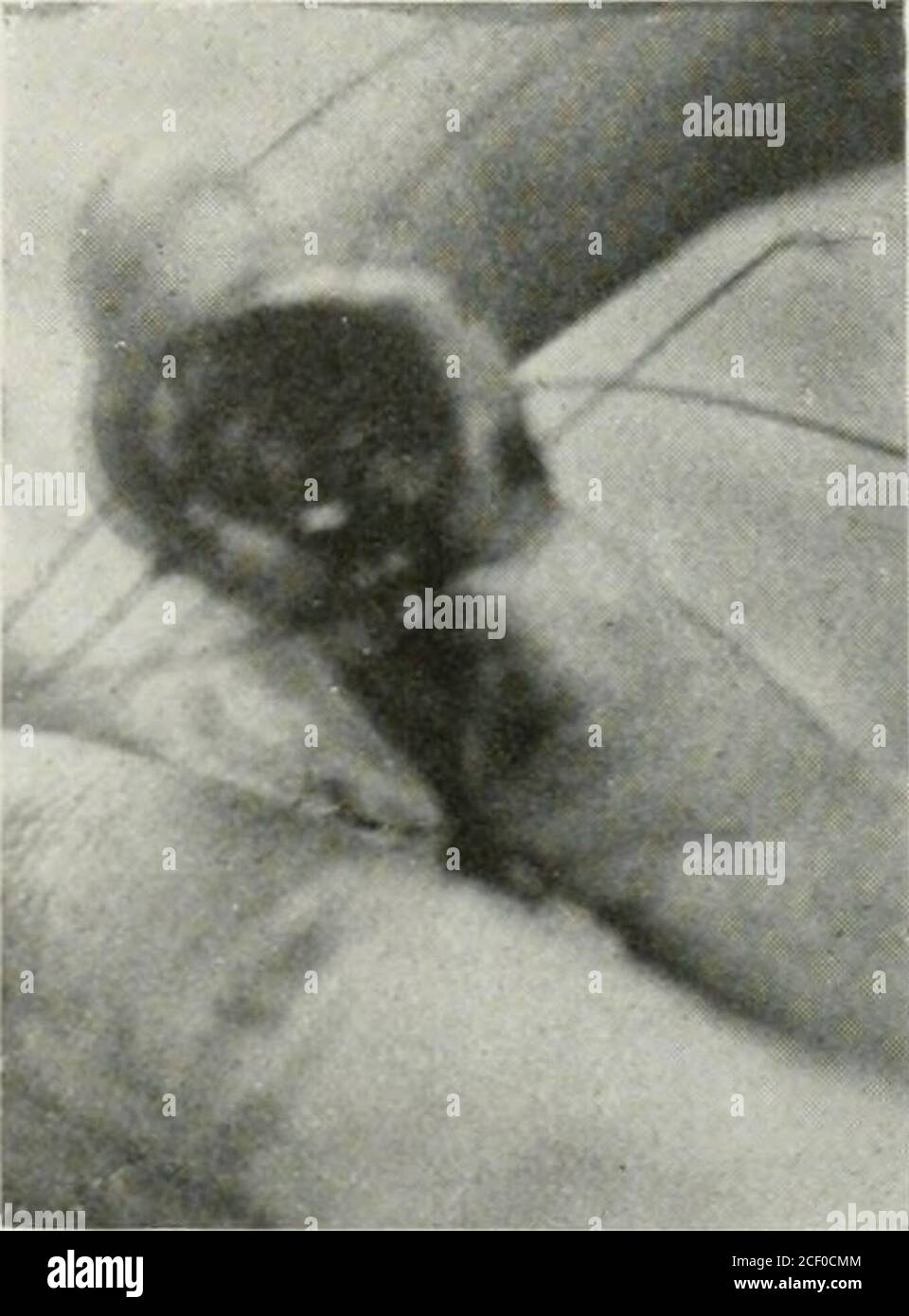 . Annals of surgery. Same as Fig. 7 (two months after operation).Dorsal ...