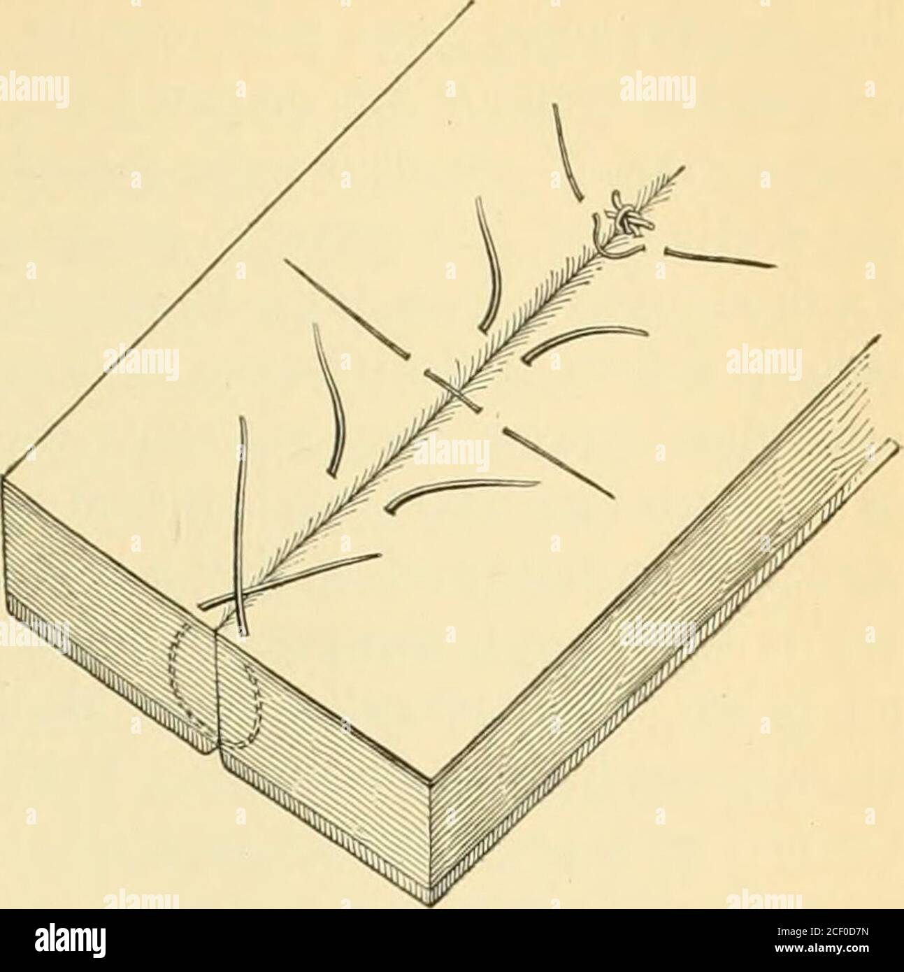 Muscle knots hi-res stock photography and images - Alamy