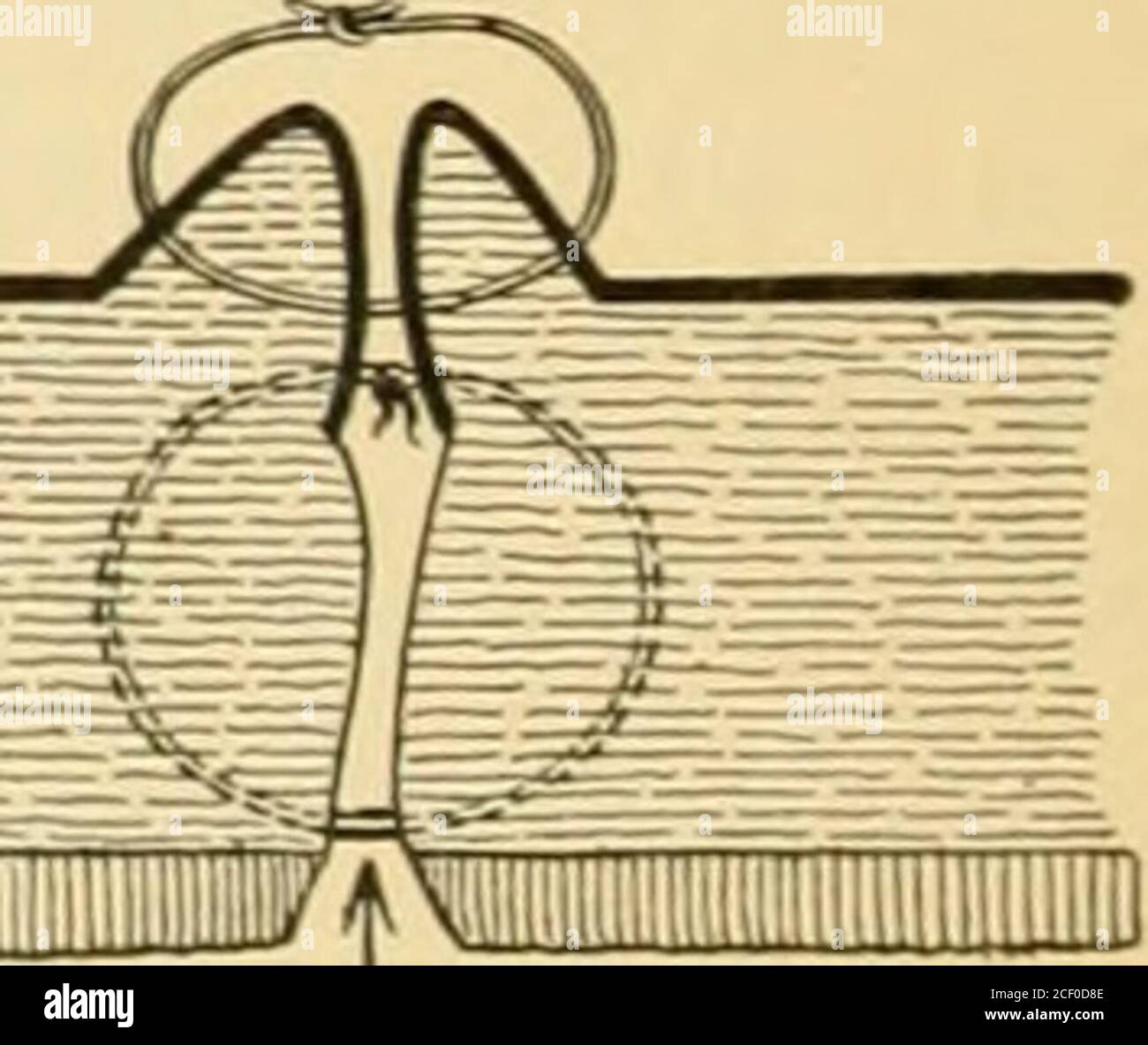 Muscle knots hi-res stock photography and images - Alamy