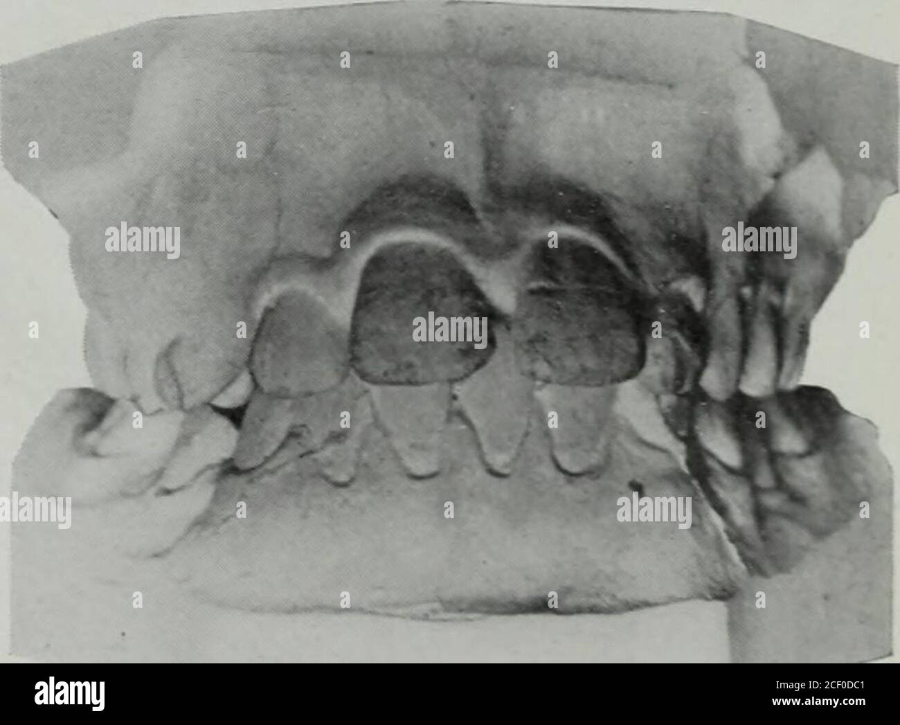 . The Dental cosmos. Let us consider the first case. In Fig.9, T and T ...