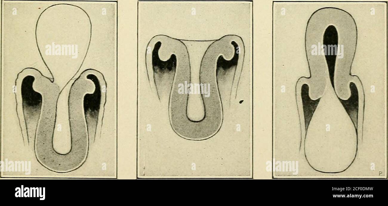 . The Principles and practice of gynecology : for students and ...
