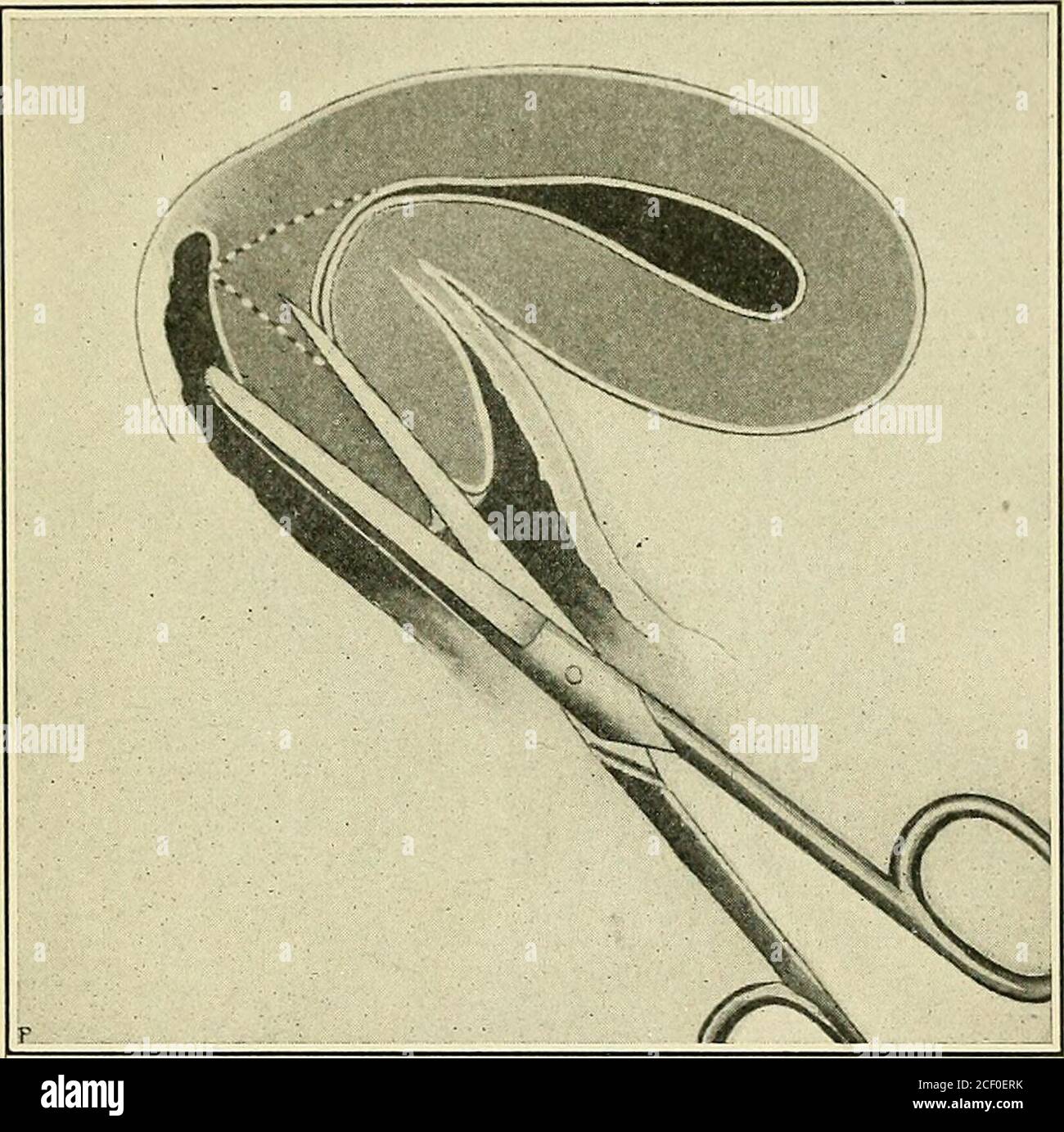 Anteversion hi-res stock photography and images - Alamy