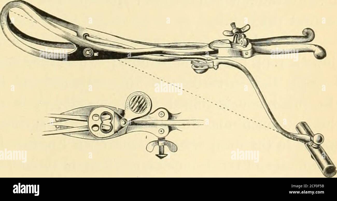 Obstetrician forceps hi-res stock photography and images - Alamy