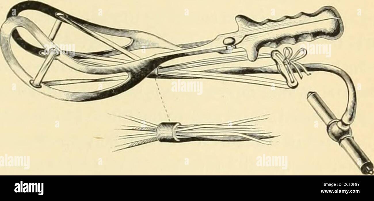 . An American text-book of obstetrics. For practitioners and students ...