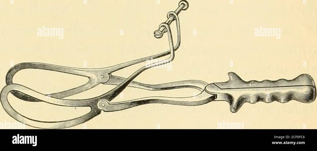 Axis traction forceps hi-res stock photography and images - Alamy