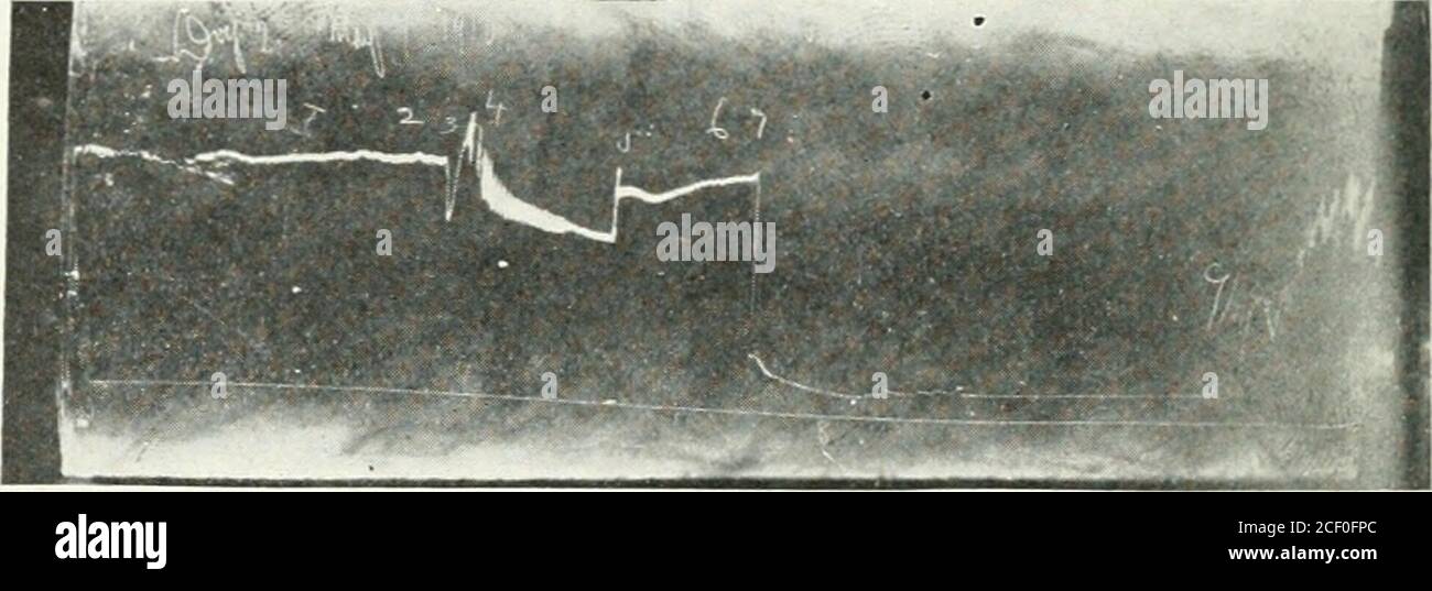 . Annals of surgery. Experiment 18. Fig. 10.. Experiment 20. Fig. II ...