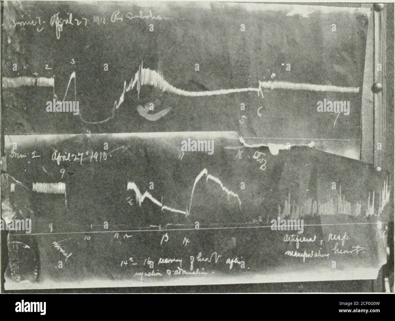 . Annals of surgery. Experiment 14, DrumFig. 7.. Experiment 15. Fig. 8 ...