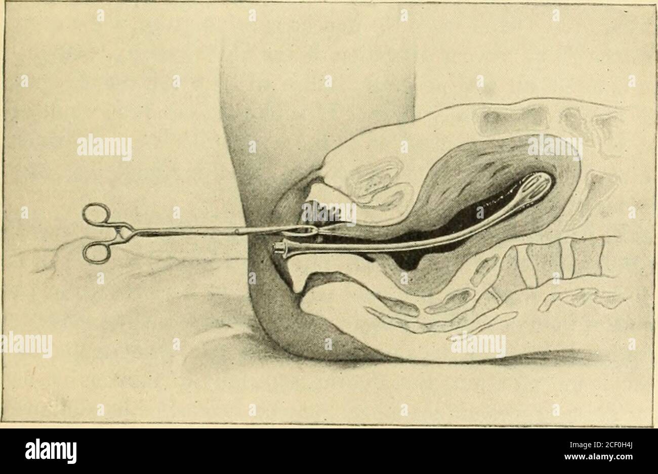 . An American text-book of obstetrics. For practitioners and students ...