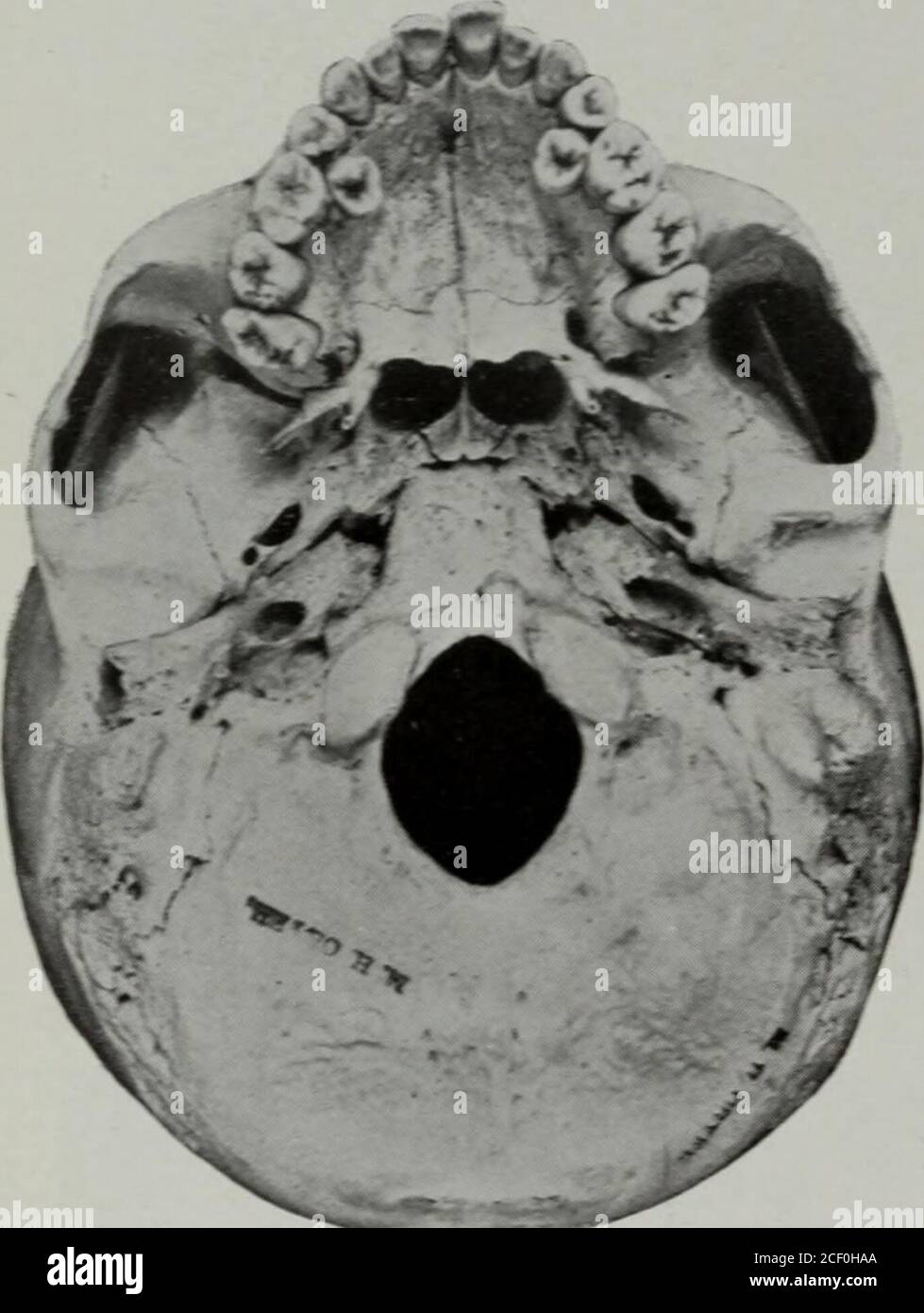 . The Dental cosmos. 3) Individuals, such as the Swiss type {ain Fig ...
