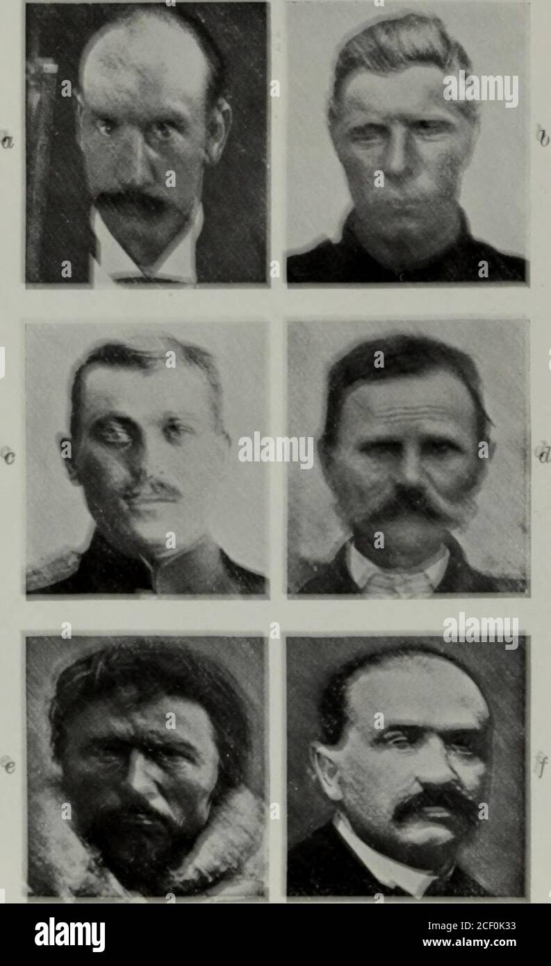 . The Dental cosmos. Norma] occlusion of child of five years. (F. C ...