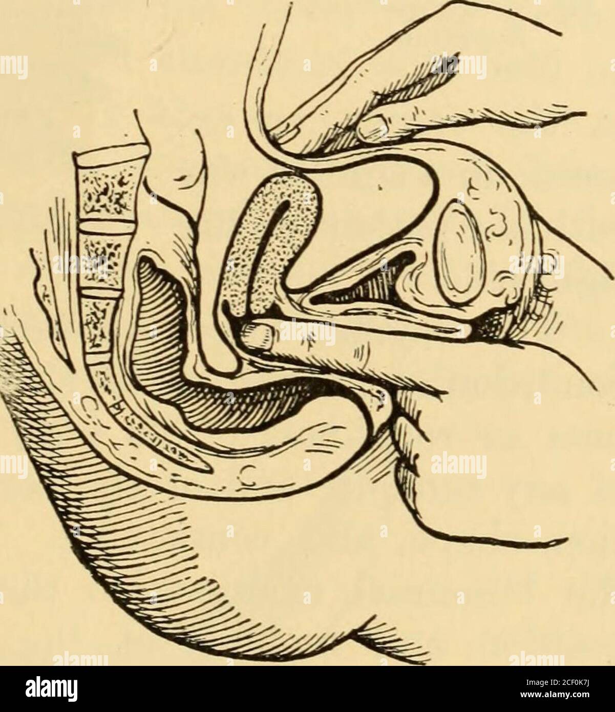 Bimanual examination hi-res stock photography and images - Alamy