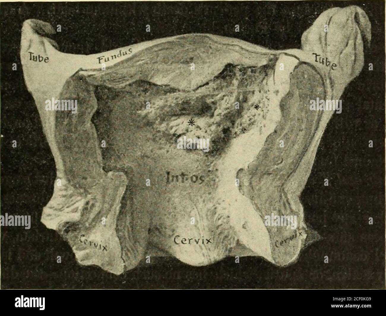 . An American text-book of obstetrics. For practitioners and students ...