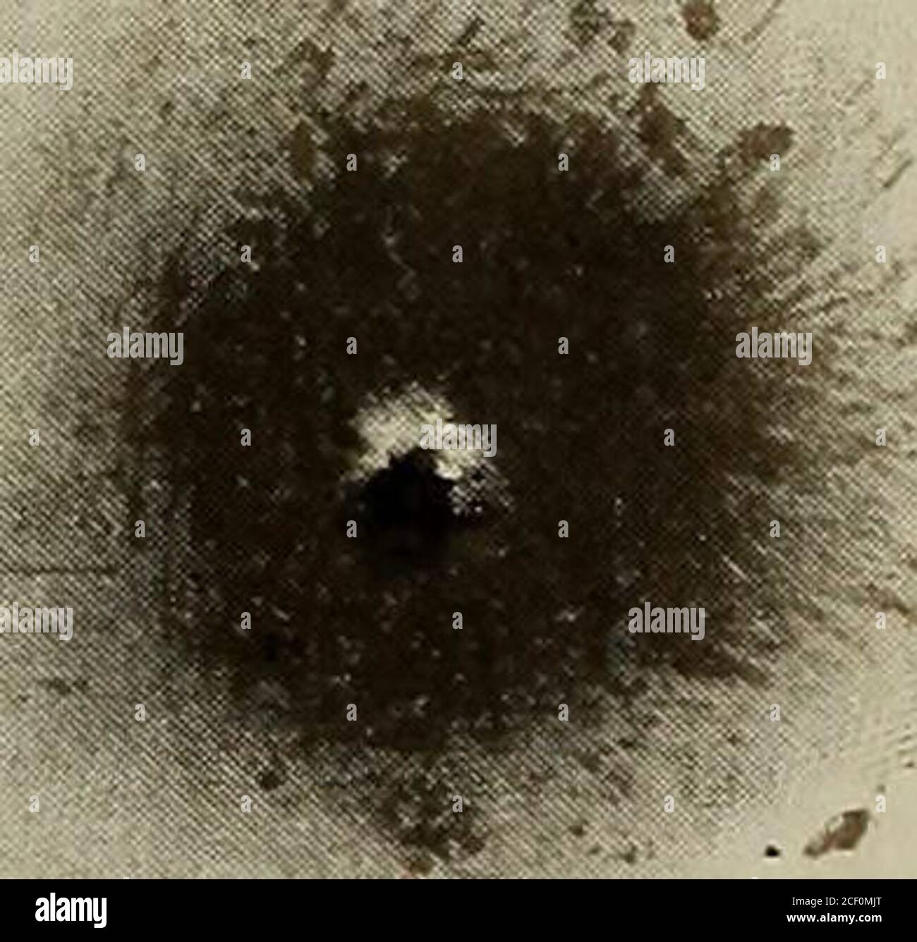 . Postmortem pathology; a manual of the technic of post-mortem ...