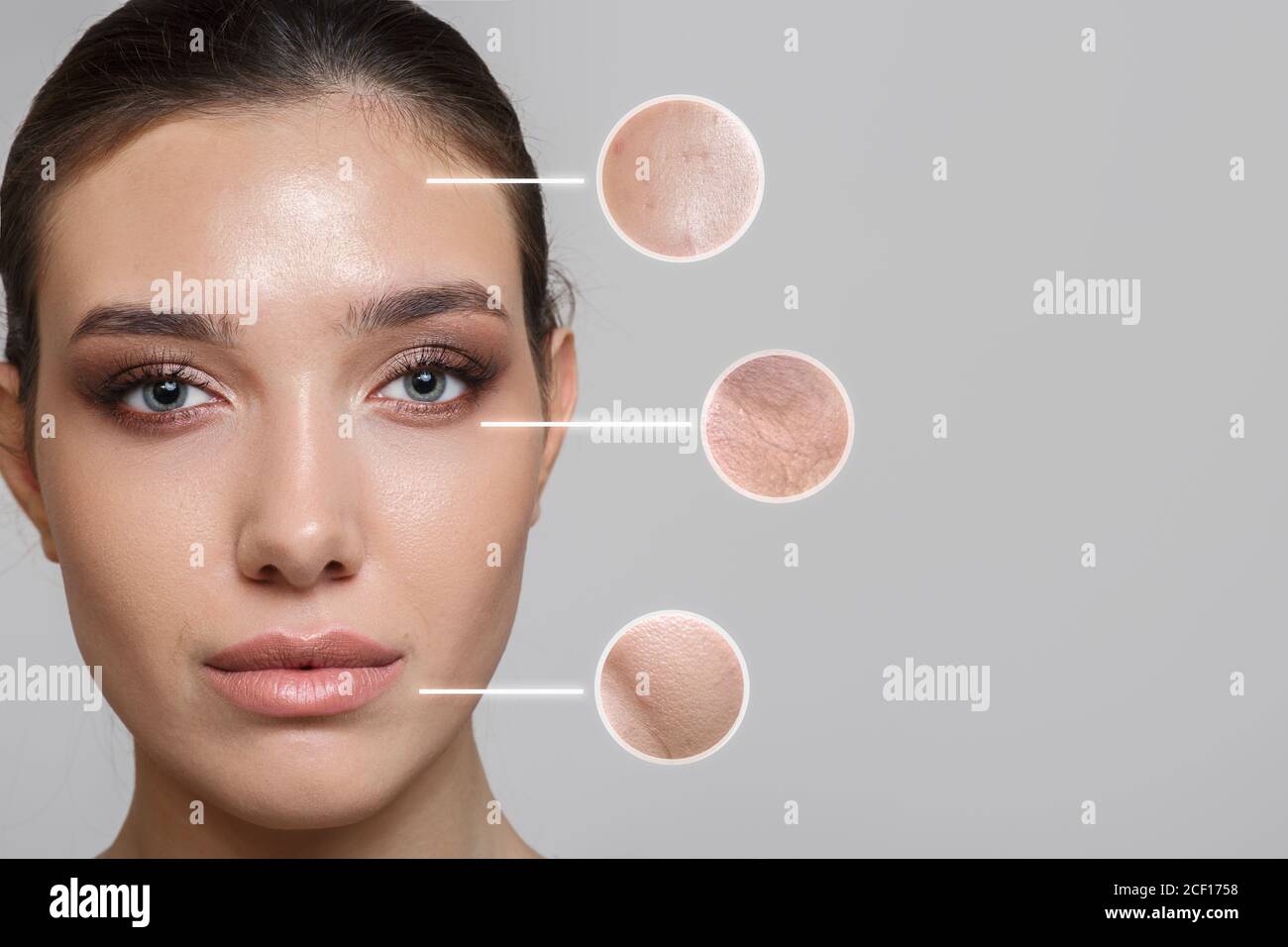 Mature Woman Acne Face High Resolution Stock Photography and Images - Alamy