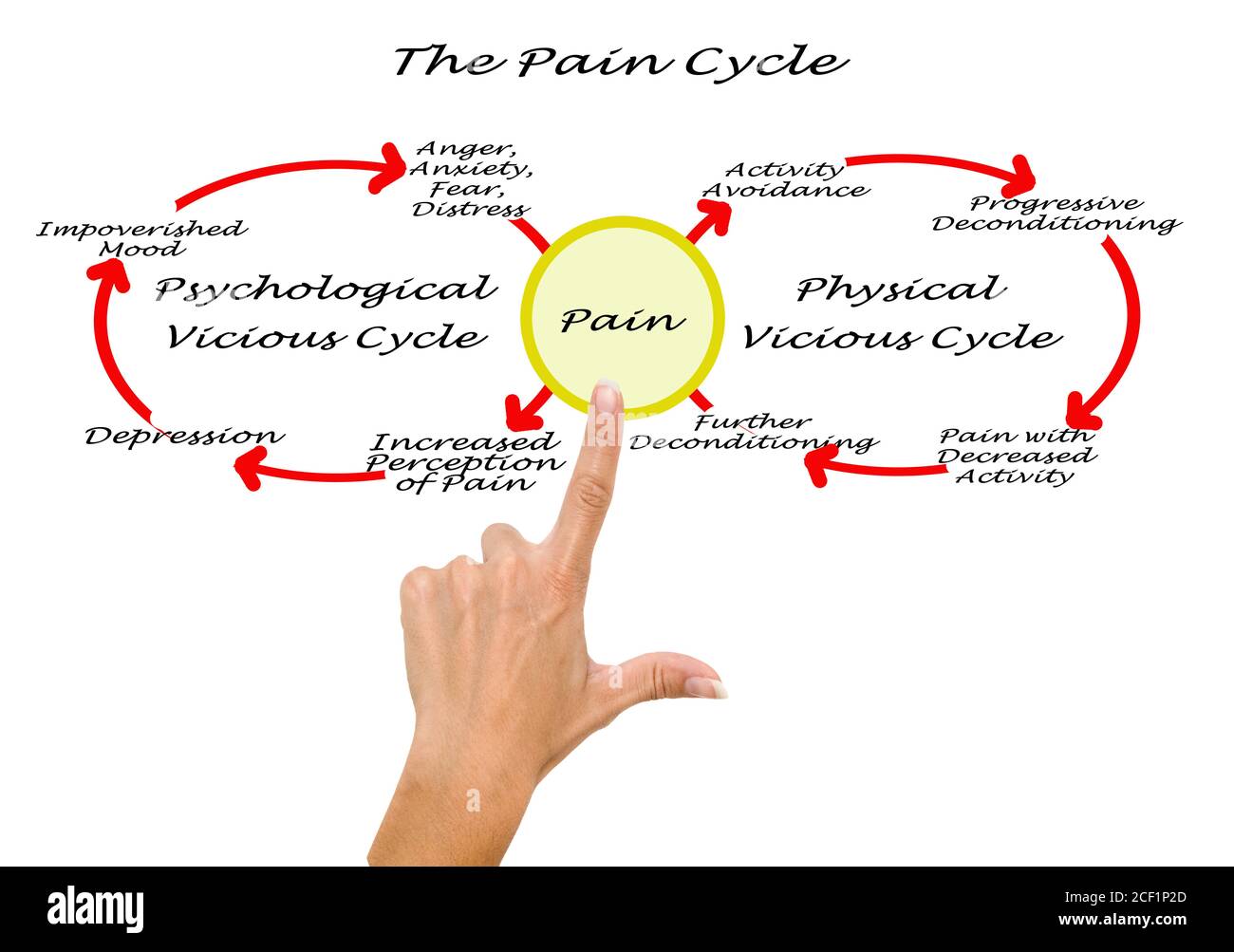 Pain Cycle: Physiolgy and Psychology Stock Photo - Alamy