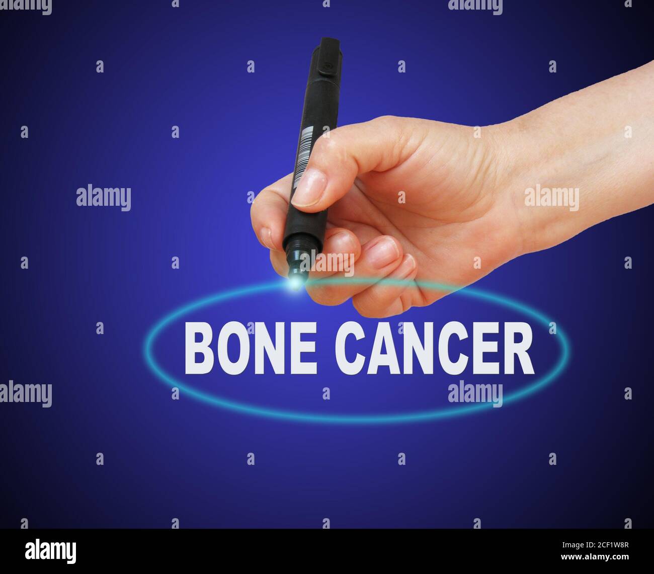 writing word BONE CANCER on gradient background made in 2d software ...