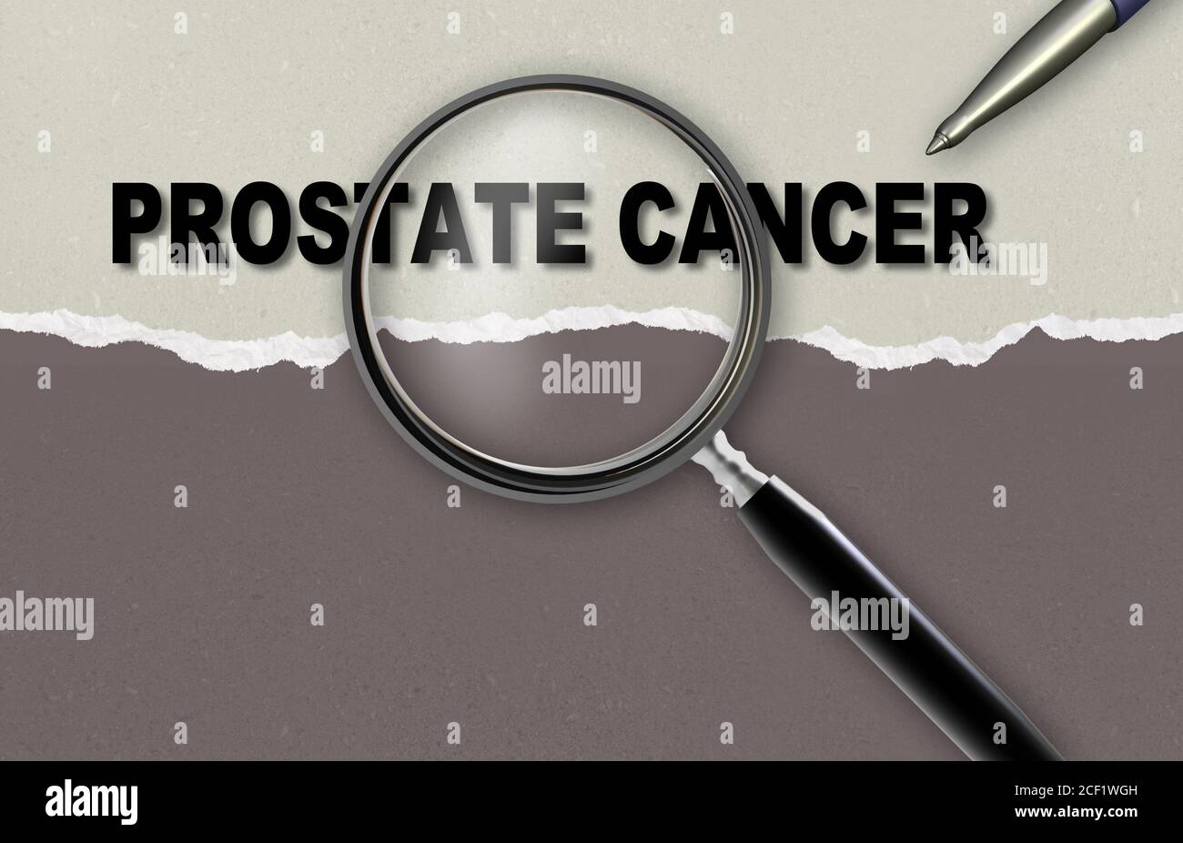 Prostate disease hi-res stock photography and images - Alamy