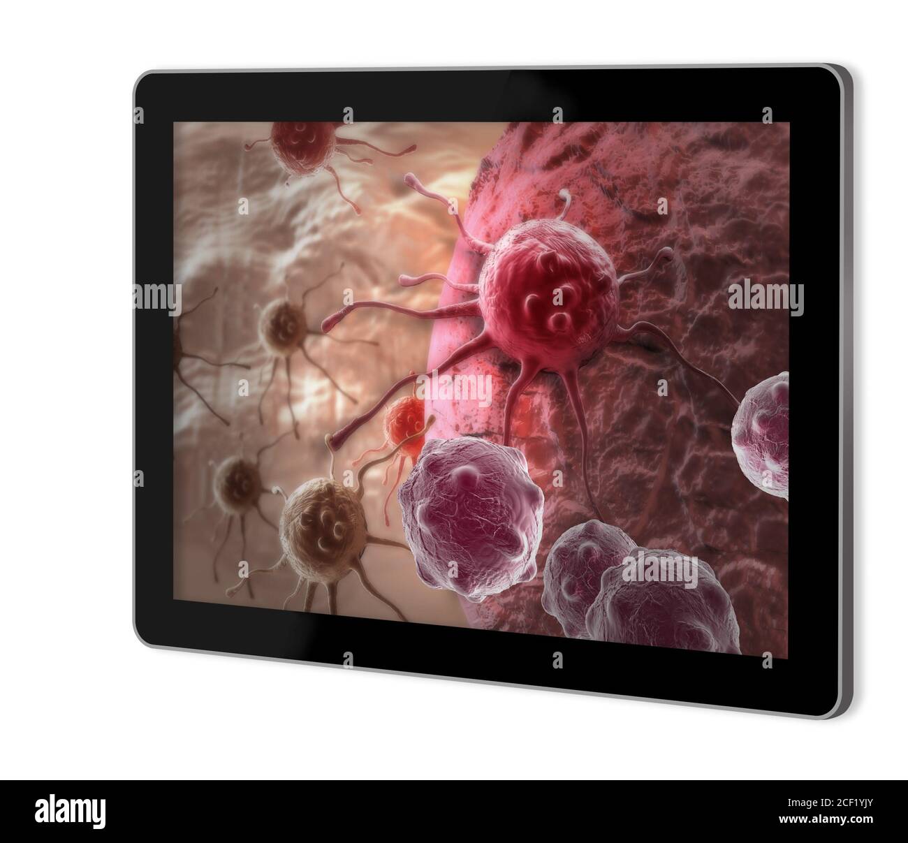 Cancer cell white background hi-res stock photography and images - Alamy