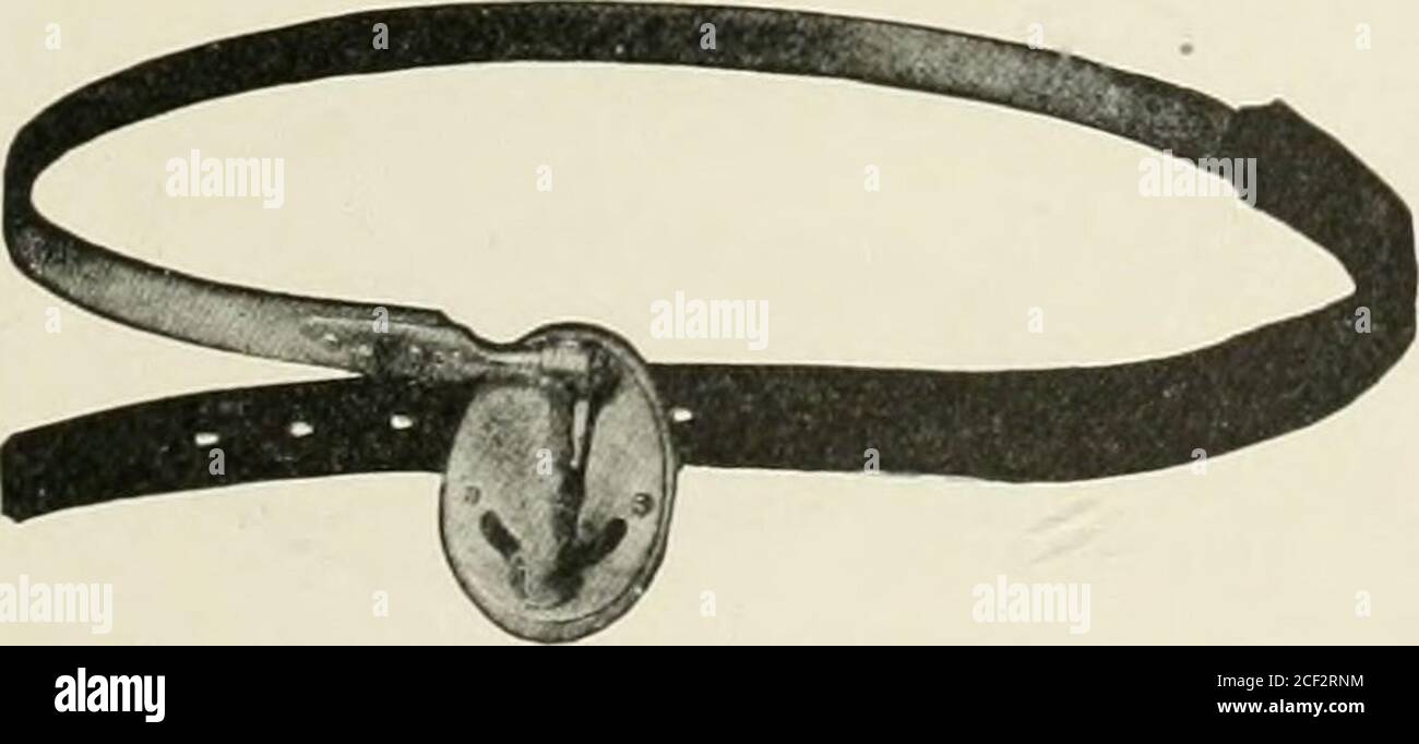 . Abdominal hernia : its diagnosis and treatment. 7. French truss with ...