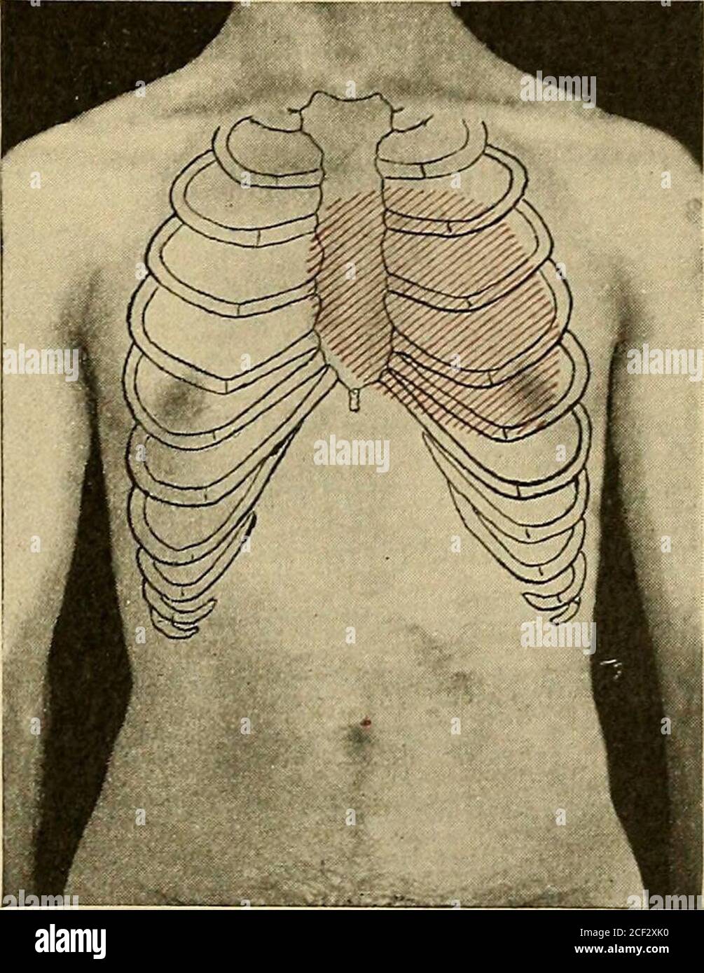 Bookiddiseasesofhe hi-res stock photography and images - Alamy