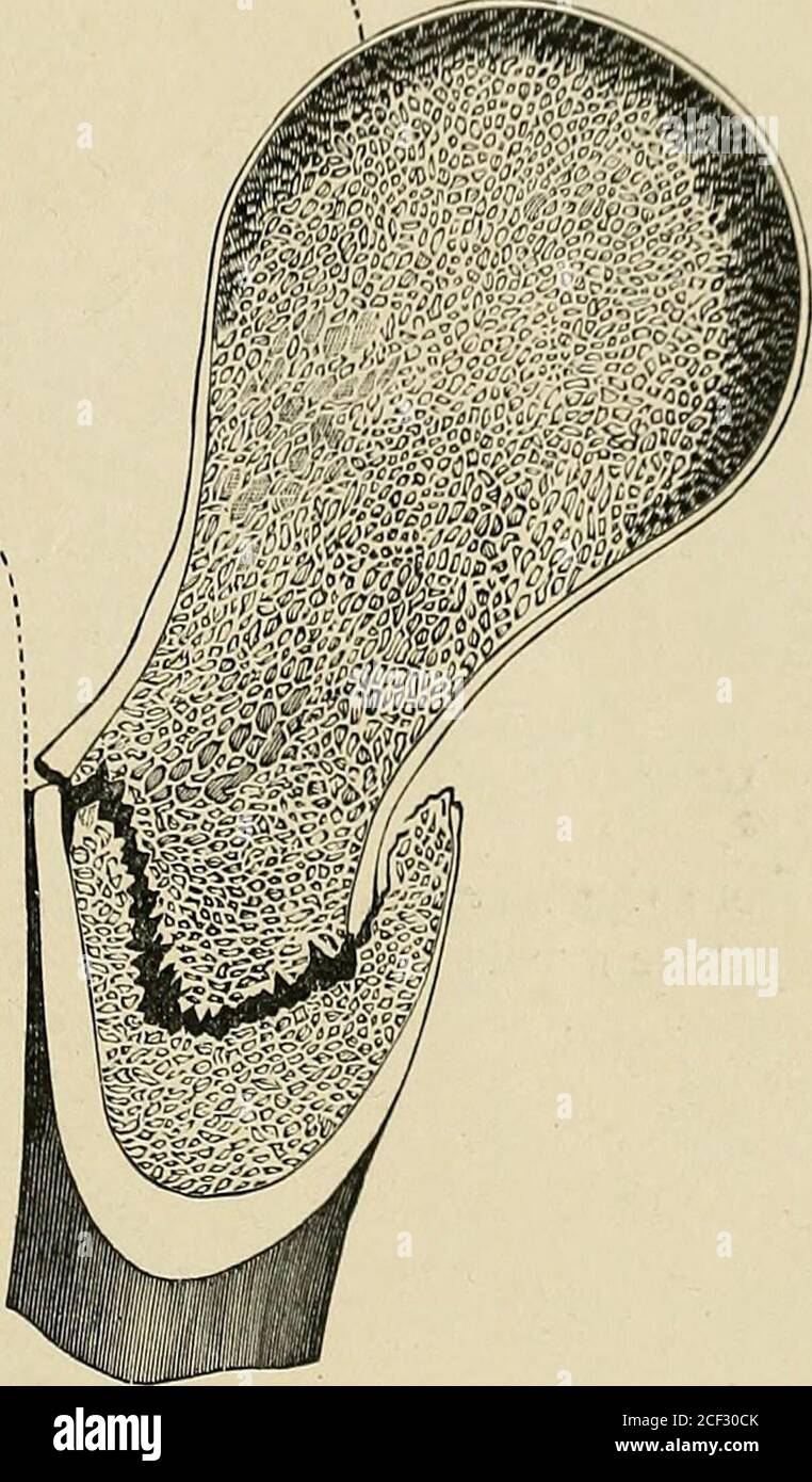 . A practical treatise on fractures and dislocations. Separation of the ...