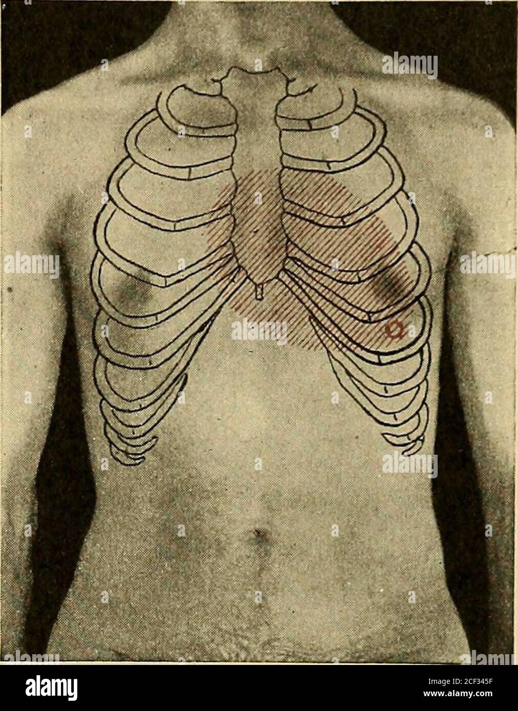 Precordium Of Heart