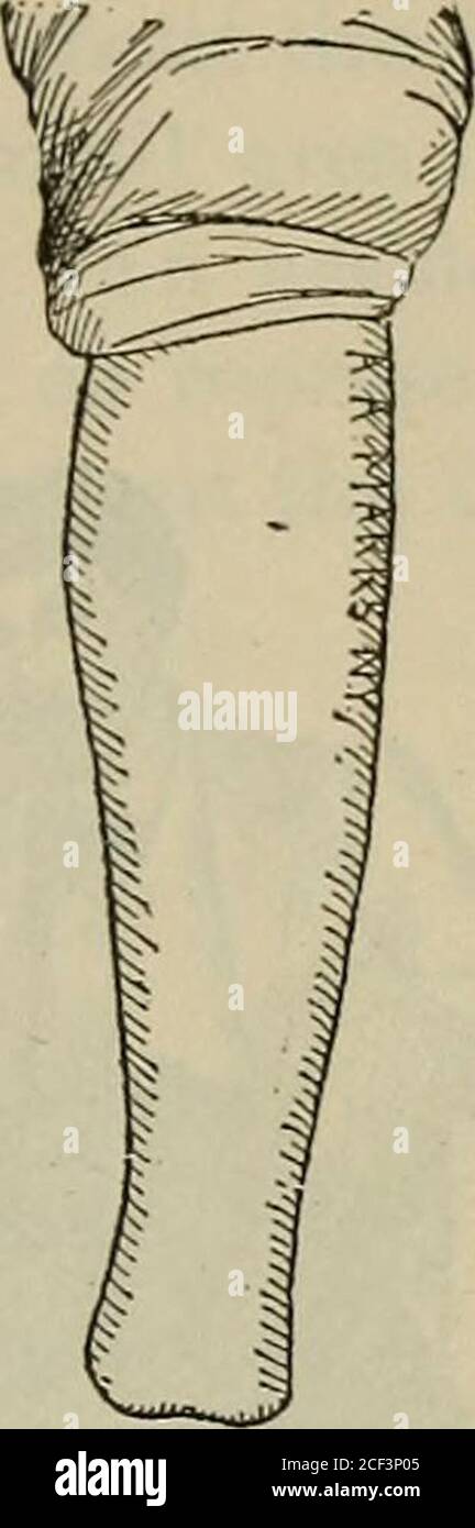 . A treatise on artificial limbs with rubber hands and feet ... No. 649 ...