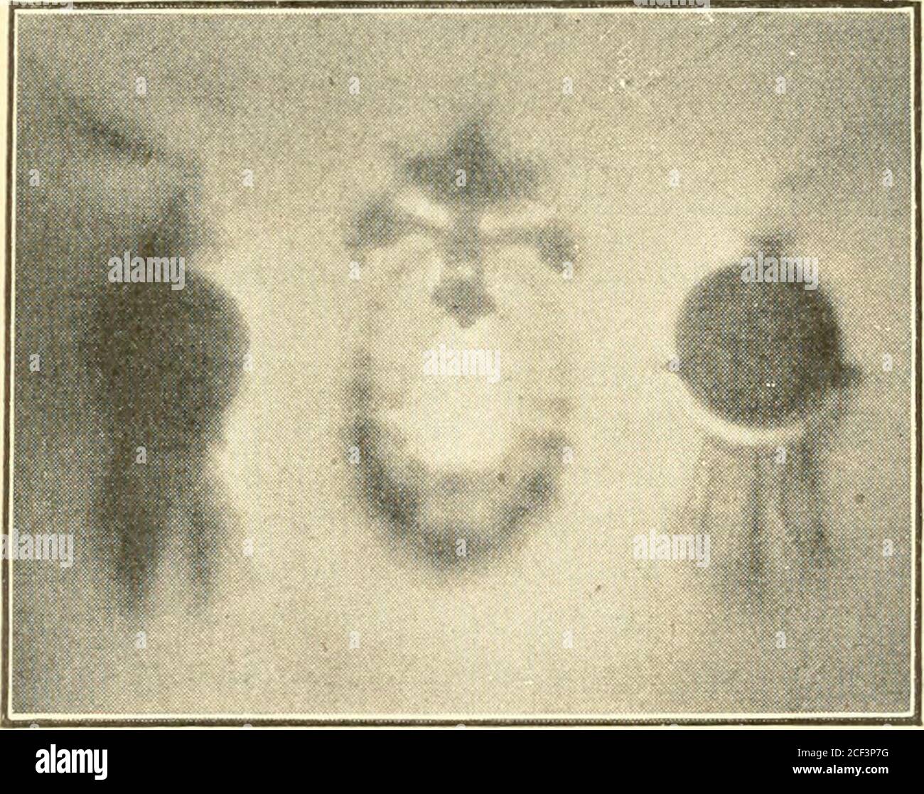 Radium 225 hi-res stock photography and images - Alamy