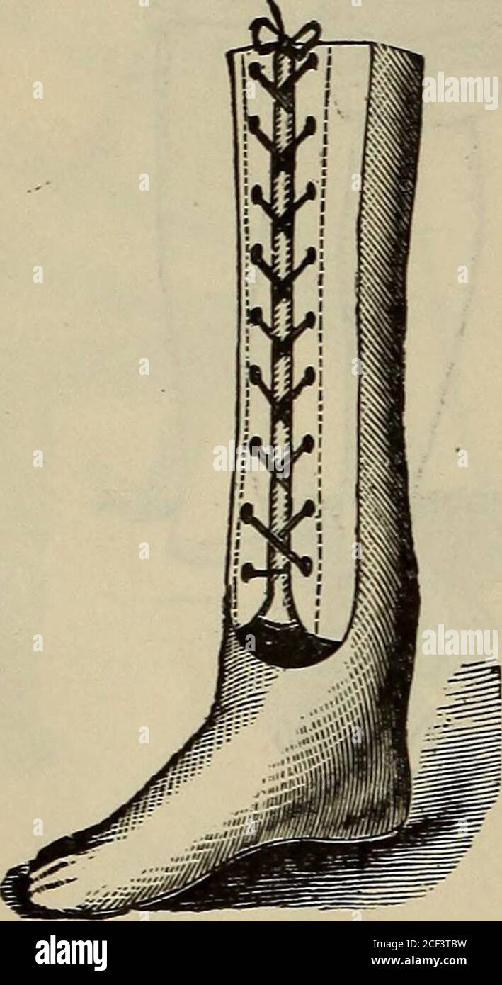 Symes amputation hi-res stock photography and images - Alamy