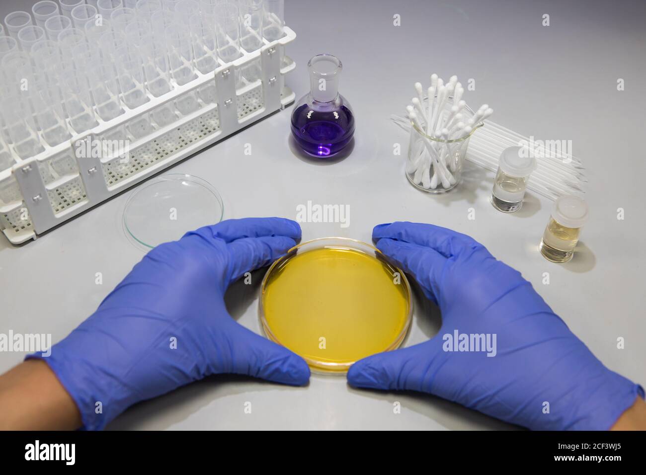 Staphylococcus agar hi-res stock photography and images - Alamy