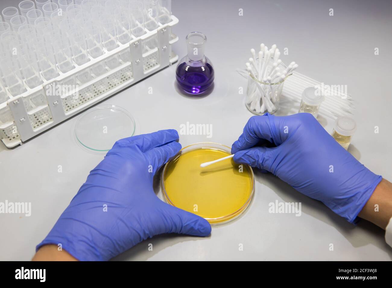 Glass test meningitis hi-res stock photography and images - Alamy