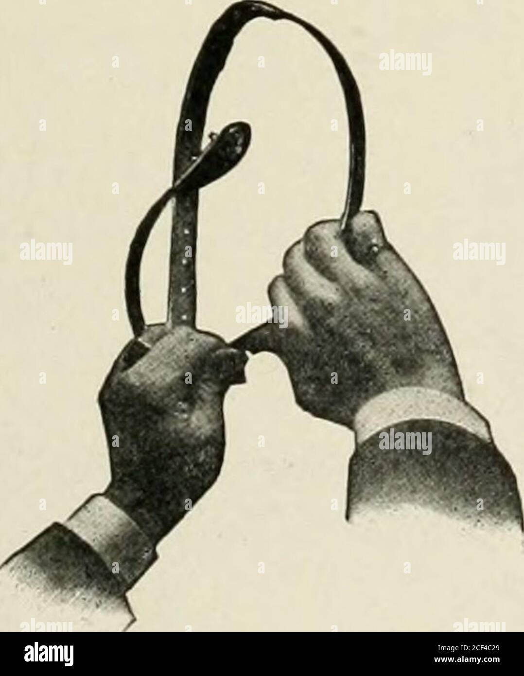 . Abdominal hernia : its diagnosis and treatment. 3-Shaping truss ...