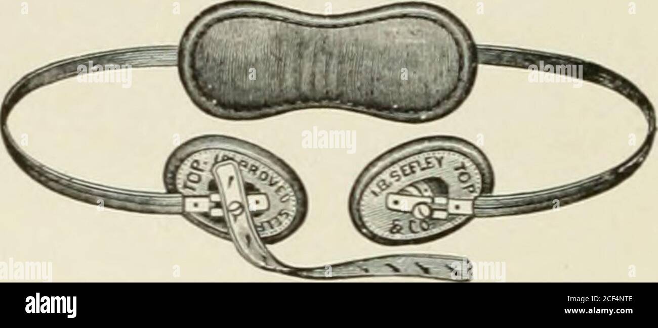 . Abdominal hernia : its diagnosis and treatment. J. Spring and elastic ...