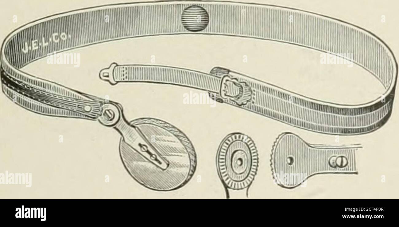 . Abdominal hernia : its diagnosis and treatment. 2. Spring and elastic ...