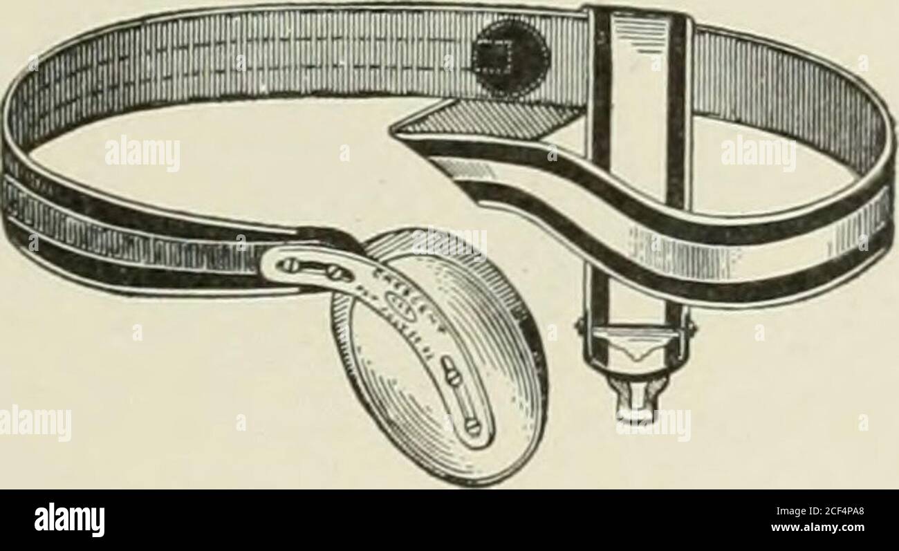 . Abdominal hernia : its diagnosis and treatment. I. Wire-Spring Truss ...