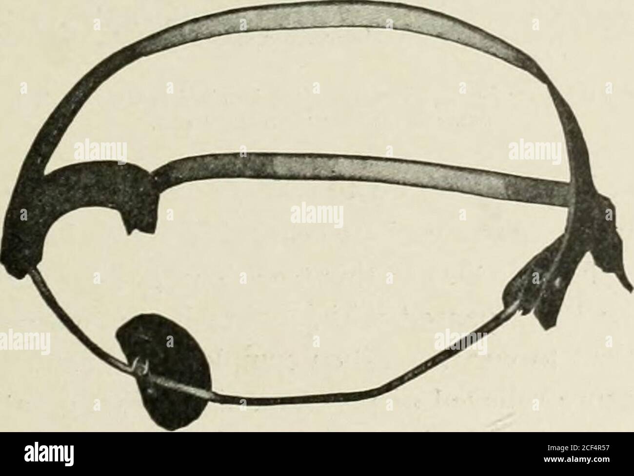 . Abdominal hernia : its diagnosis and treatment. 72. 140 ABDOMINAL ...