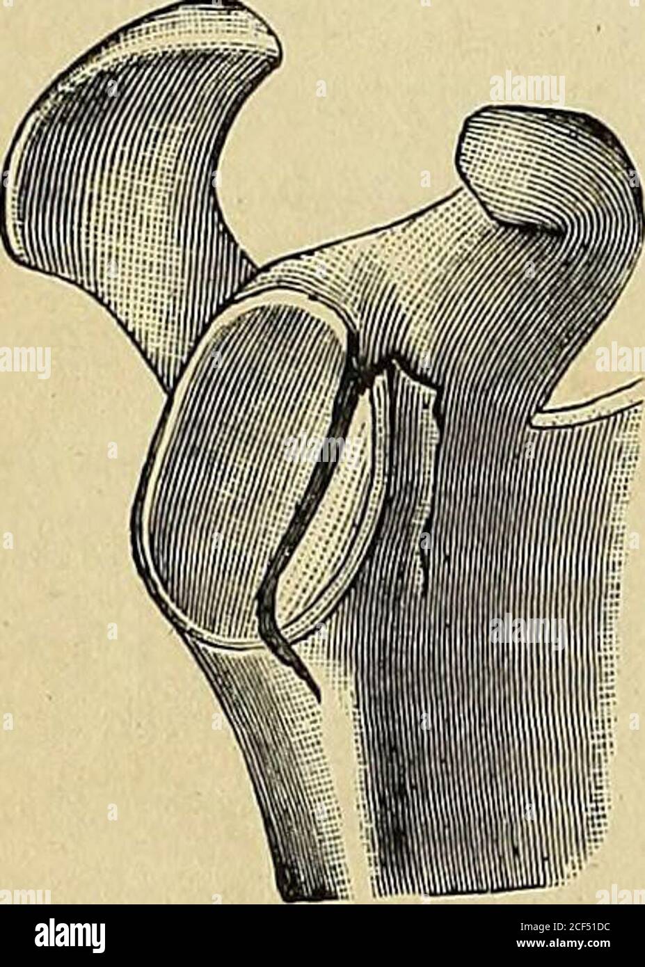 . A practical treatise on fractures and dislocations. s. Poland x ...