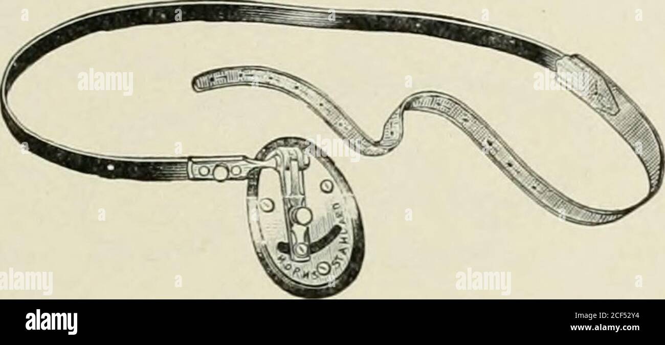 . Abdominal hernia : its diagnosis and treatment. I. Chase truss.. 2 ...