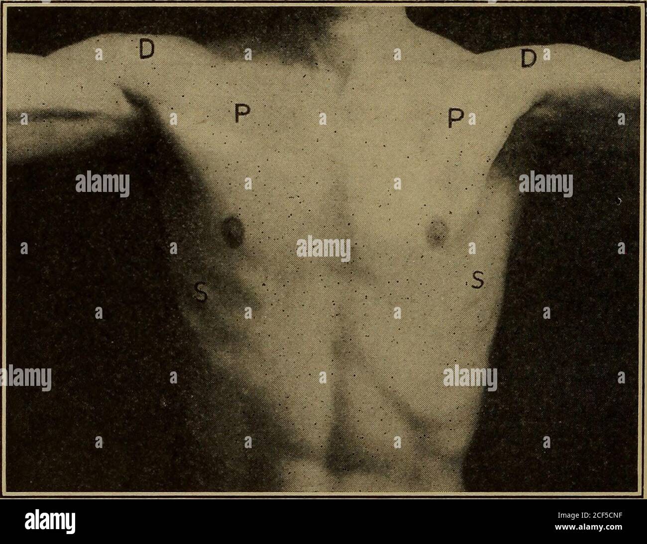 Movements of shoulder joint hi-res stock photography and images - Alamy