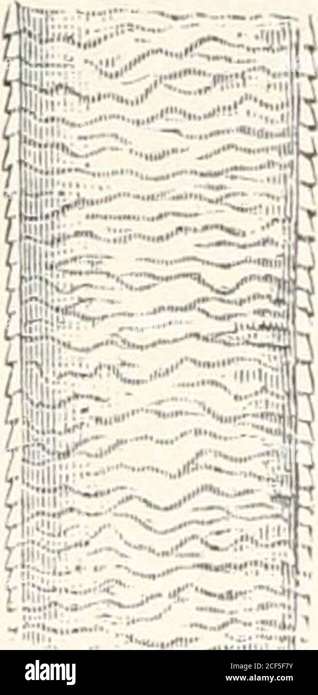 . The microscope and its revelations. ucture of the human hair isin ...
